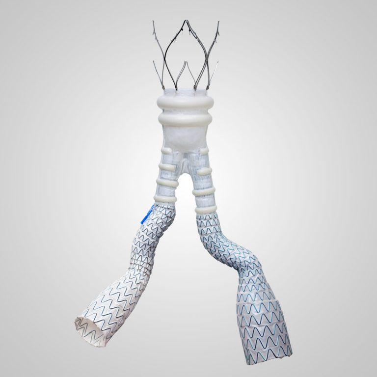 Deborah Now Offering ALTO® Abdominal Stent Graft System to Patients to ...