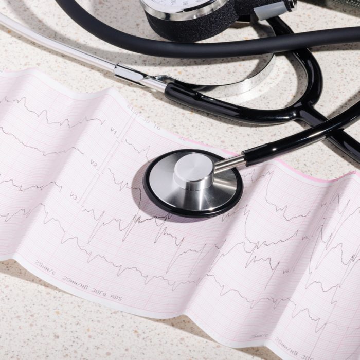 Muhammad Raza, MD | Interventional Cardiologist | Deborah Heart & Lung ...