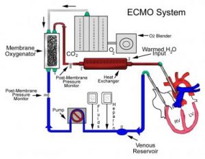 Extracorporeal Membrane Oxygenation (ECMO) – Deborah Heart & Lung Center